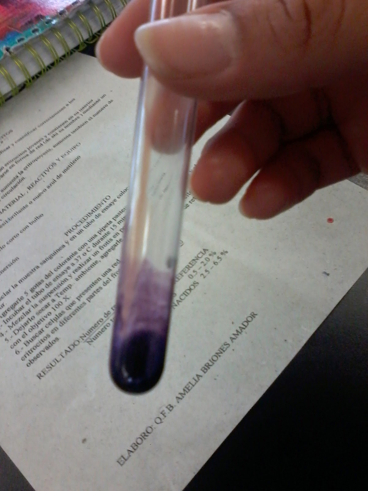 cuaderno de practicas de laboratorio: TINCIÓN SUPRAVITAL CON AZUL DE ...